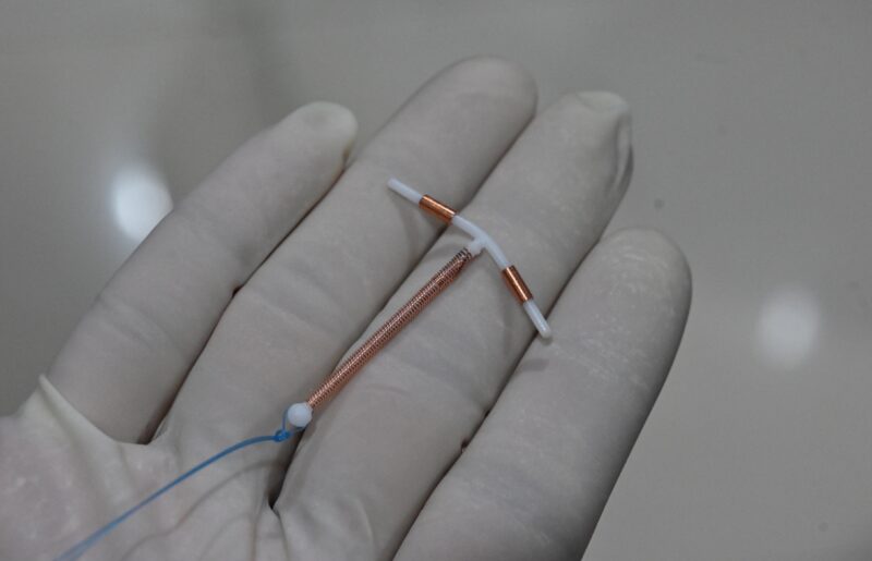 Is IUD Removal Painful? Why Some Are Refusing To Remove It - Betches