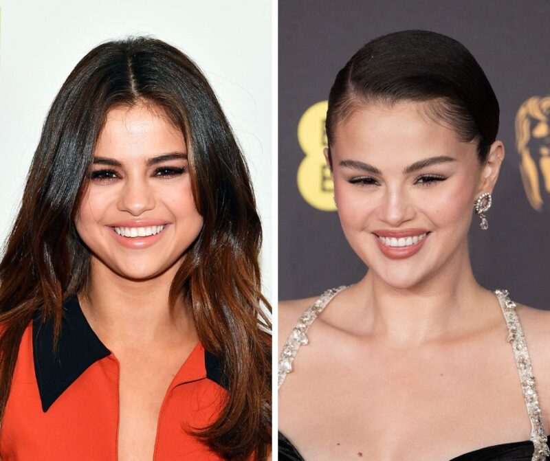 Did Selena Gomez Get Veneers? Before & After New Smile - Betches